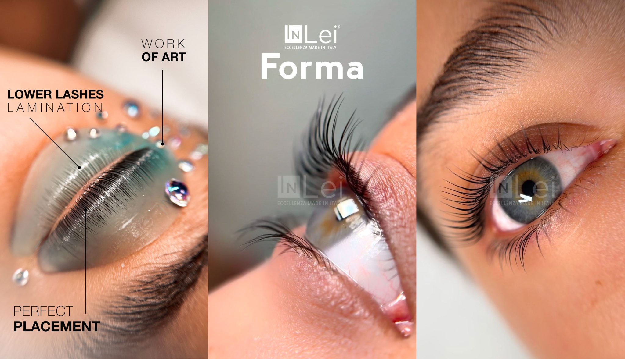 The curl revolution: the InLei® Forma Up shield - Inlei